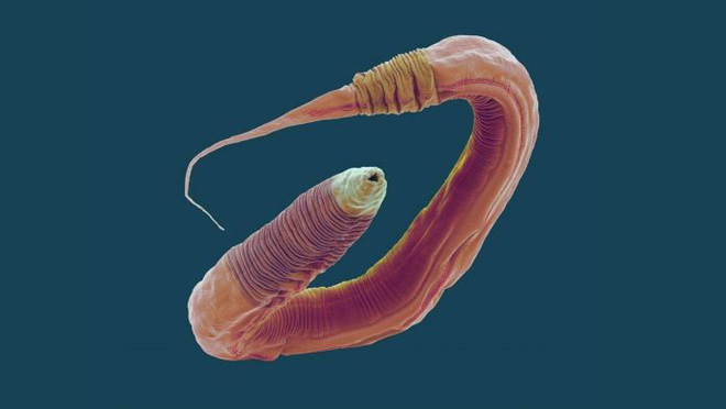 Chỉnh sửa gen giúp các nhà khoa học tăng 500% tuổi thọ của giun, tương ...